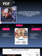 Escala ASPECTS | PDF