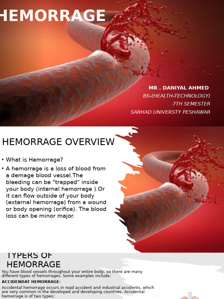 Understanding Hemorrhage: Types and Treatment | PDF | Bleeding | Blood ...