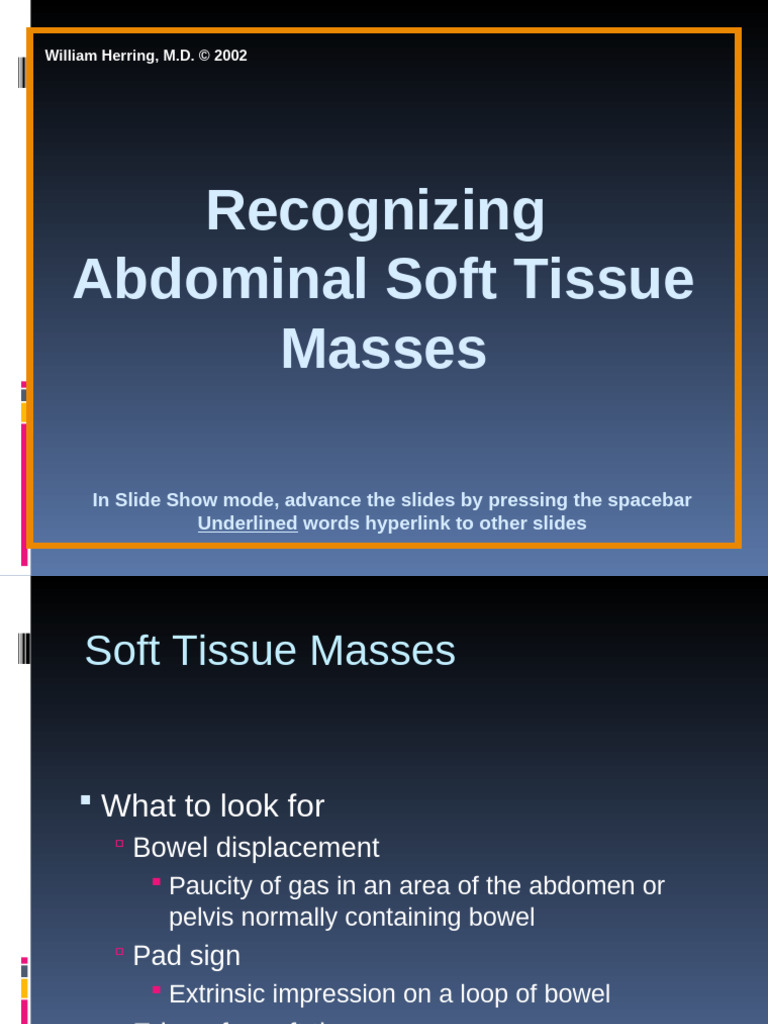 13.abdominal Soft Tissue Masses | PDF | Abdomen | Medical Specialties