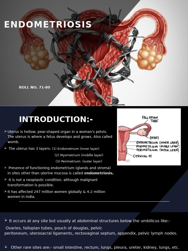 Endometriosis.ppt (1) | PDF | Uterus | Menstruation