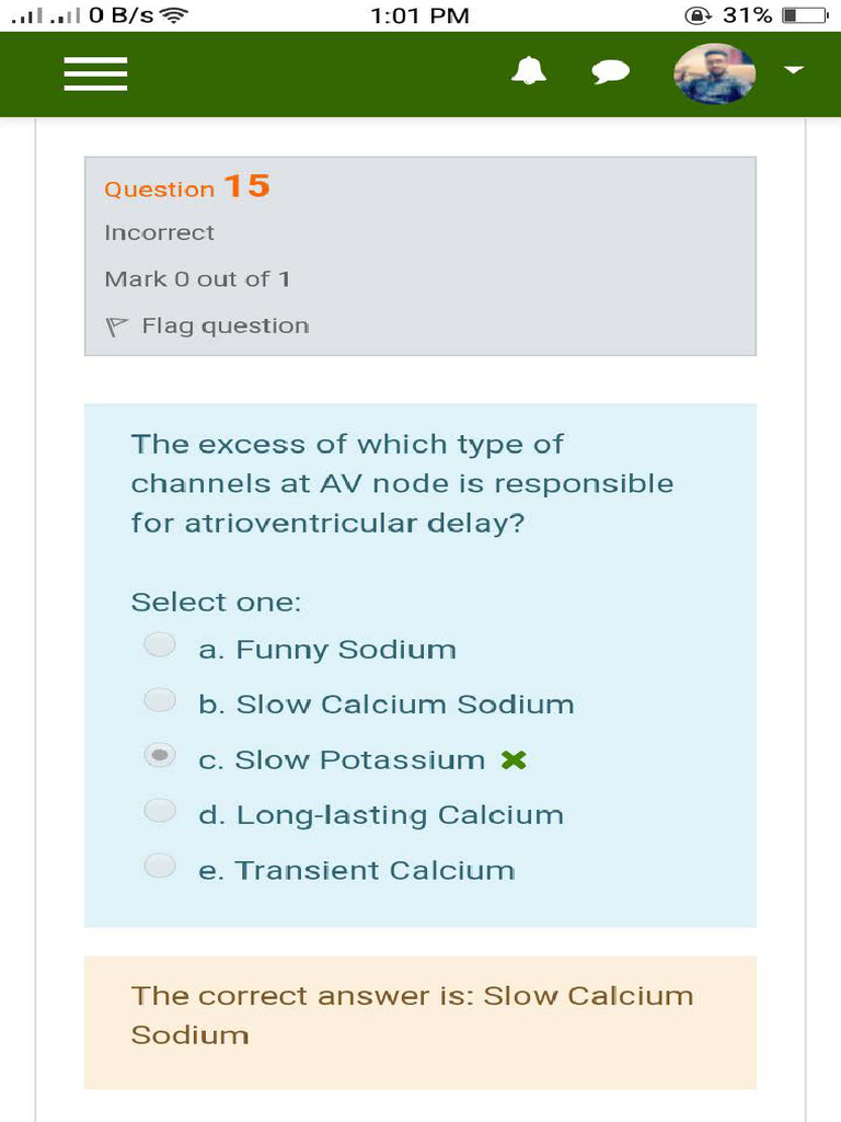 CVS Physio LSA pdf Mbbs | PDF