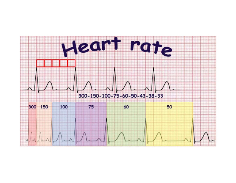 calculating ECG heart rate | PDF