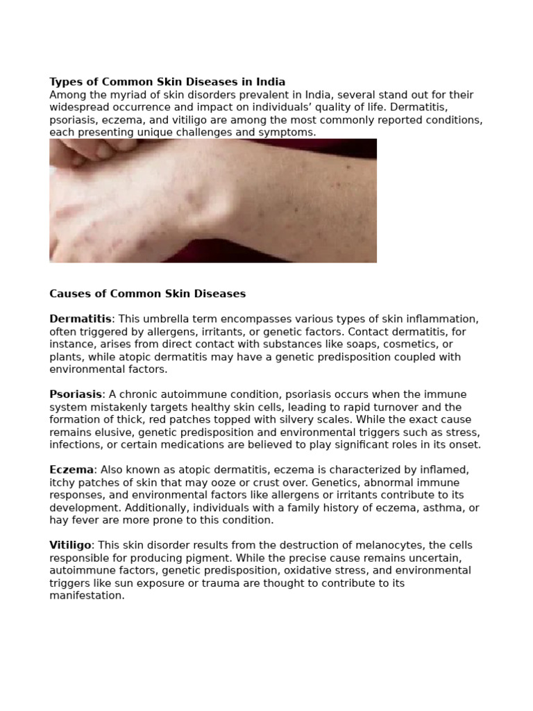 Common Skin Diseases in India Explained | PDF | Dermatitis | Psoriasis