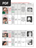 Sinuses Positioning Chart | PDF | Skull | Human Nose
