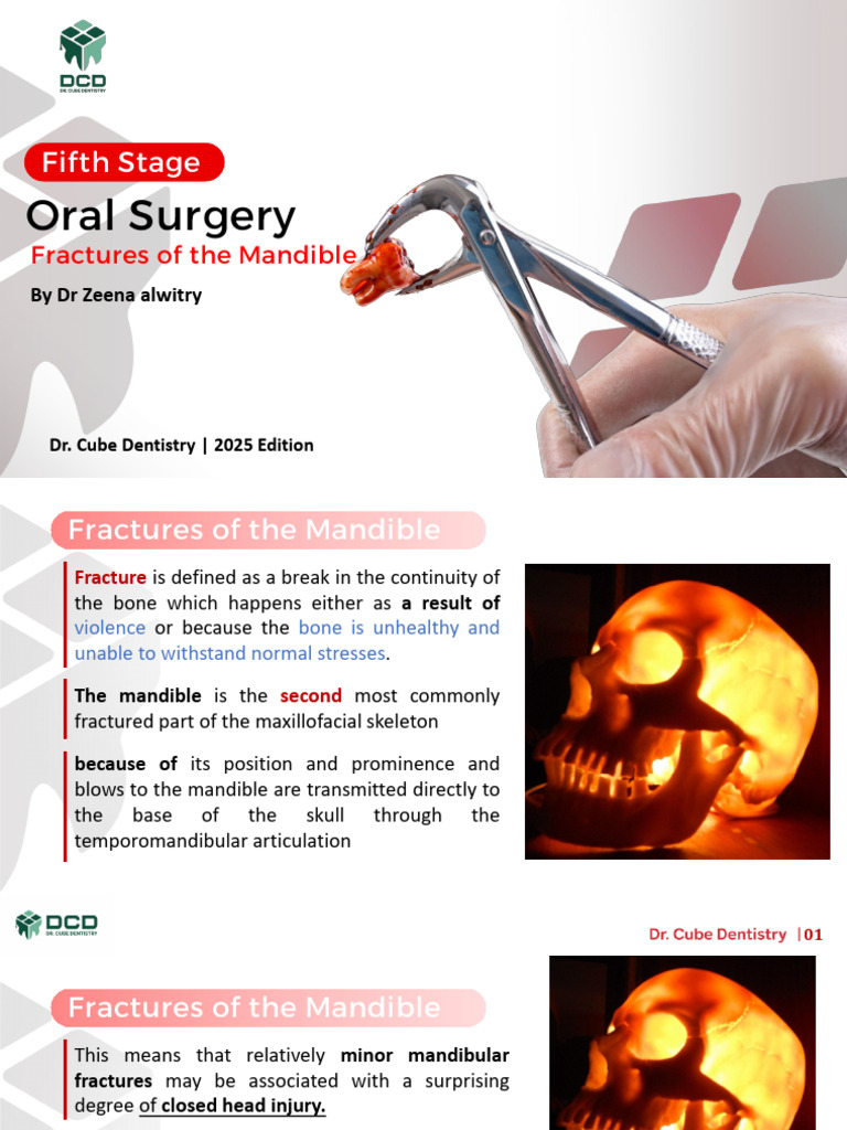 O.Surgery5 Lec.2 Fractures of The Mandible | PDF | Bone | Human Tooth