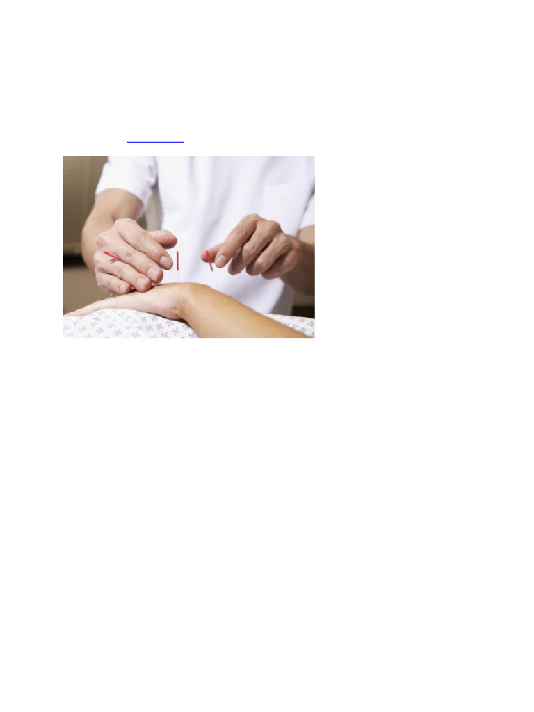 Acupuncture Benefits for Diabetes Management | PDF