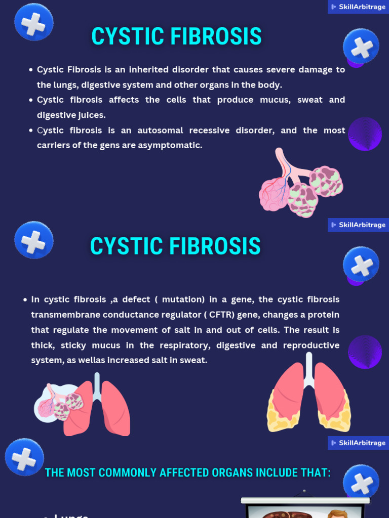 Cystic Fibrosis | PDF