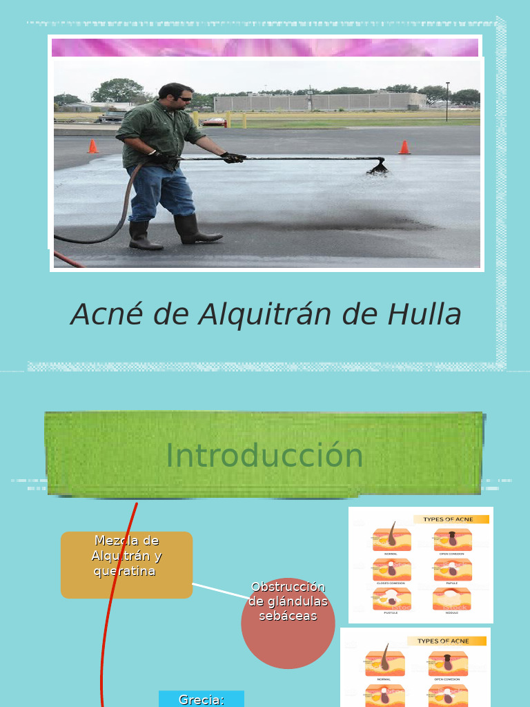 Acné de Alquitrán de Hulla: Causas y Tratamiento | PDF