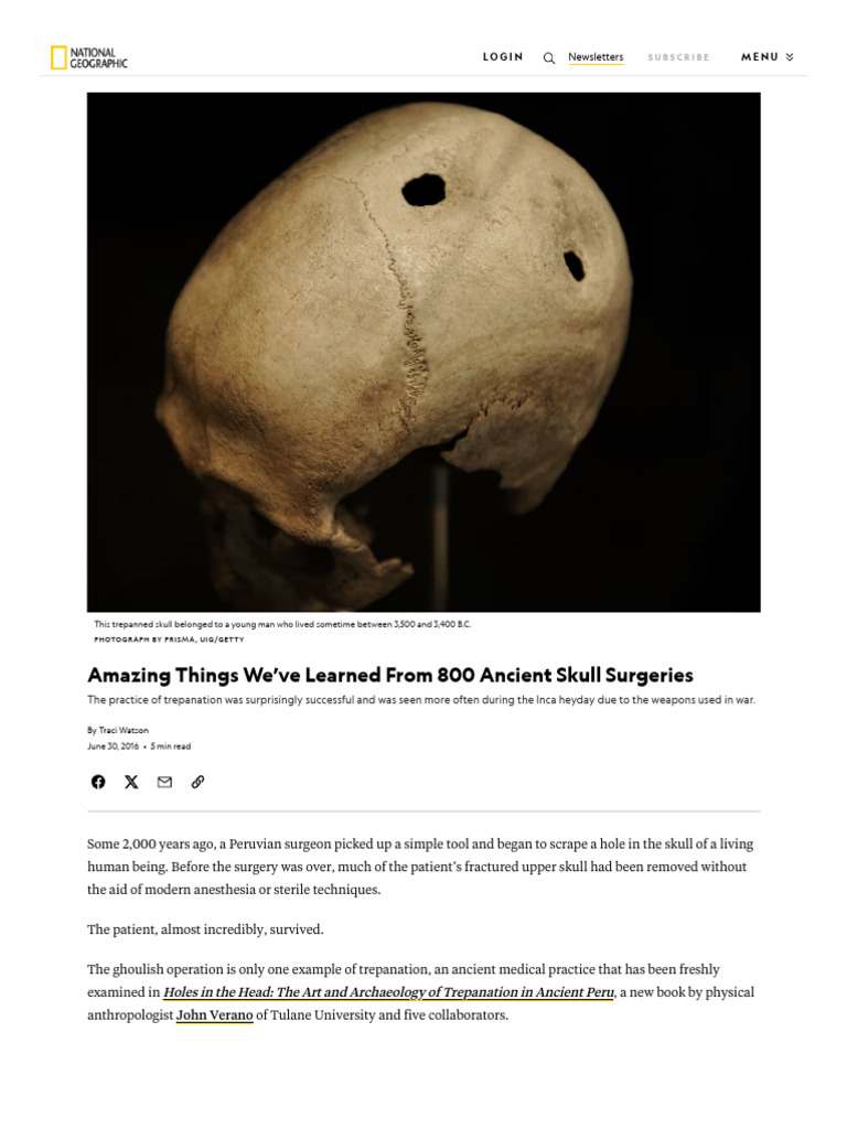 Amazing Things We've Learned From 800 Ancient Skull Surgeries 2 | PDF ...