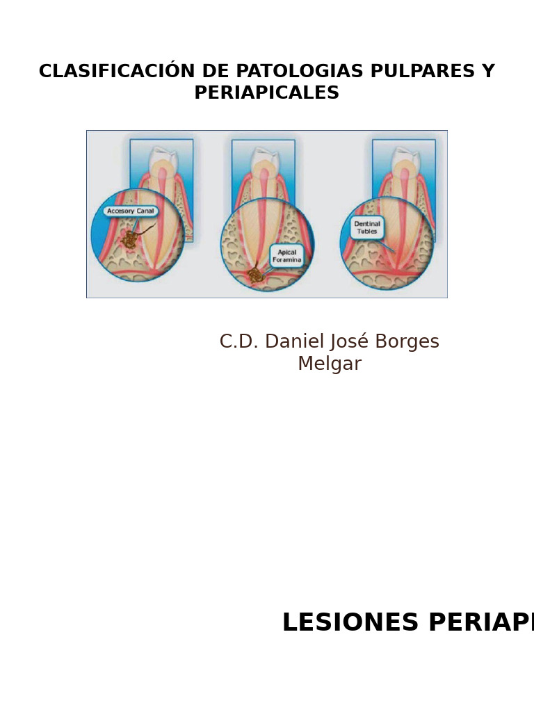 Lesiones Periapicales y Pulpares | PDF | Enfermedades y trastornos ...