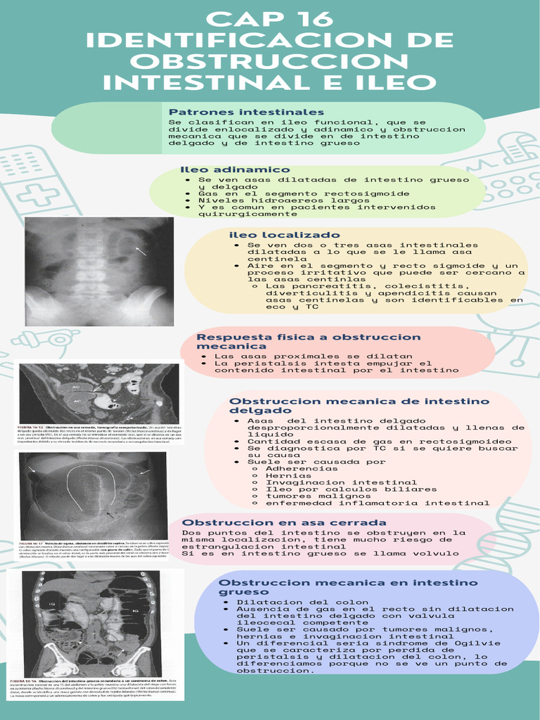 Diagnóstico de Obstrucciones Intestinales | PDF | Tracto ...