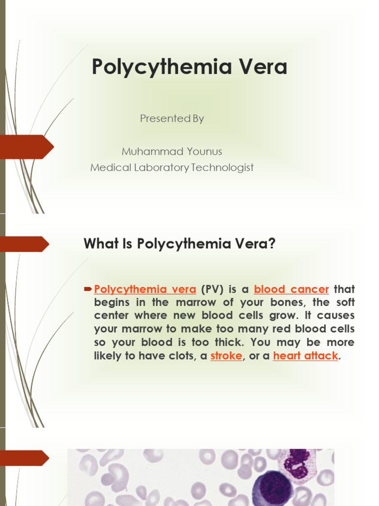 Polycythemia Vera 1700035927 | PDF | Blood | Blood Cell