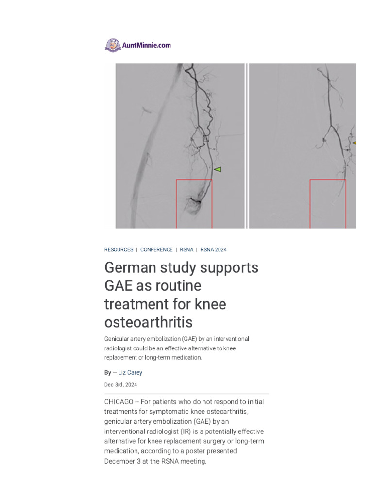 German Study Supports GAE As Routine Treatment For Knee Osteoarthritis ...
