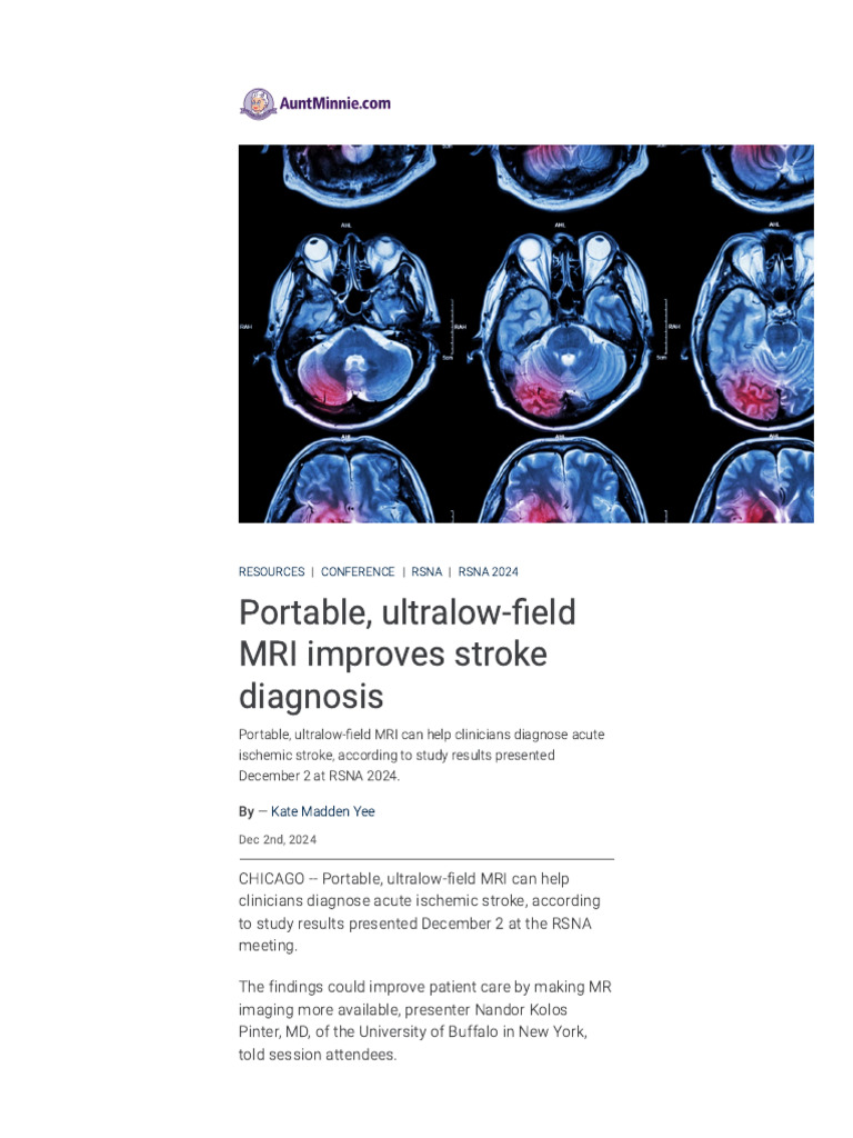 Portable Ultralow Field Mri Improves Stroke Diagnosis Auntminnie