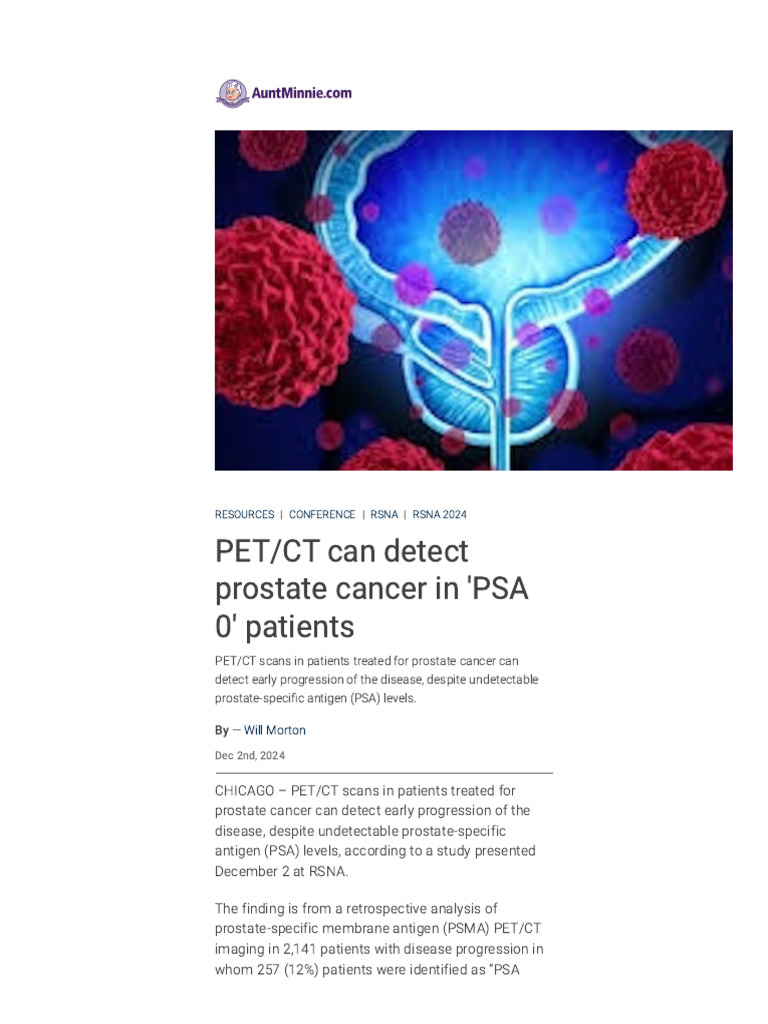PET/CT Detects Prostate Cancer in PSA 0 | PDF | Prostate Specific ...