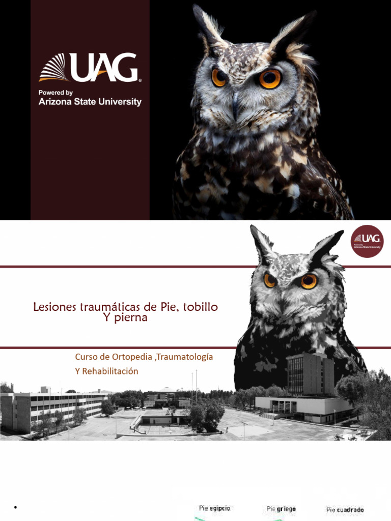 Lesiones traumaticas de pie , tobillo y pierna | PDF | Tobillo | Pie