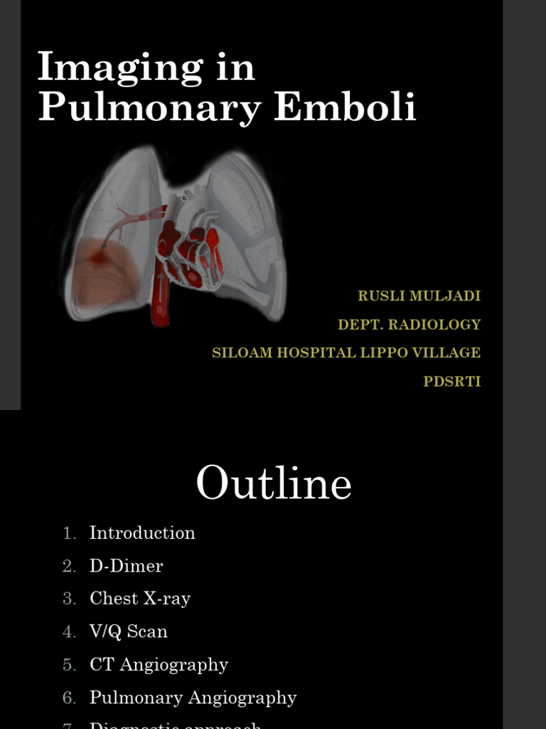 Imaging Ini Pulmonary Emboli | PDF | Embolism | Causes Of Death