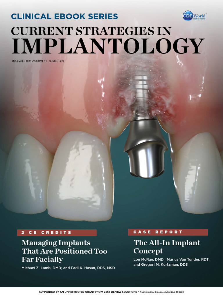 Current Strategies in Implantology | PDF | Dental Implant | Medical Specialties