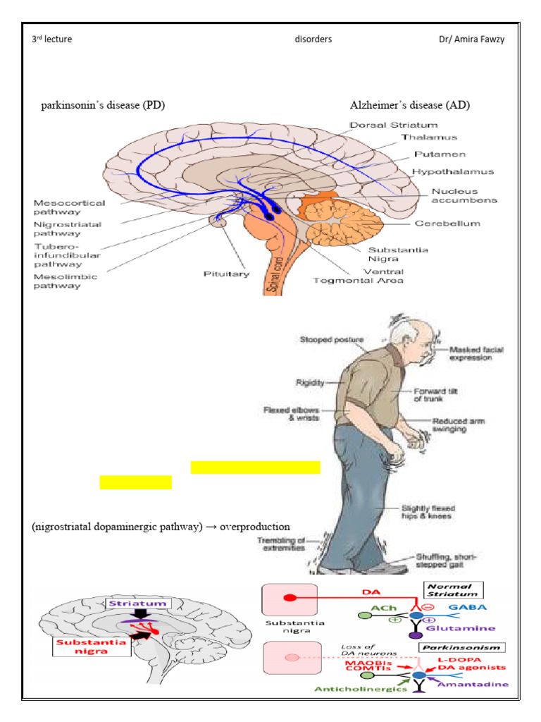 3 Degenerative Disorders | PDF | Parkinson's Disease | Dopamine