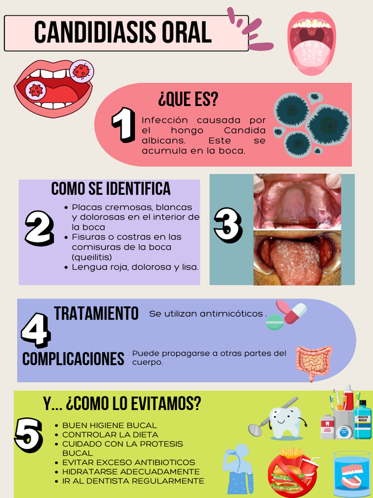 Candidiasis Oral: Prevención y Tratamiento | PDF