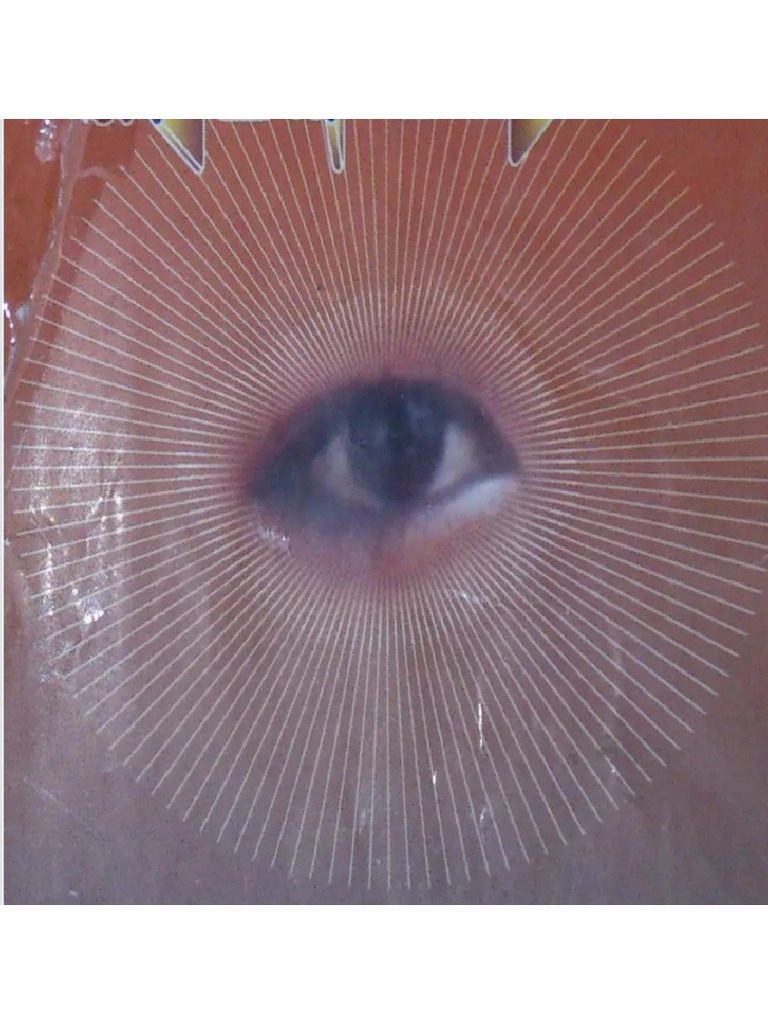 Eye | PDF