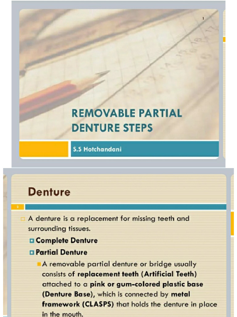 خطوات عمل Rpd | PDF