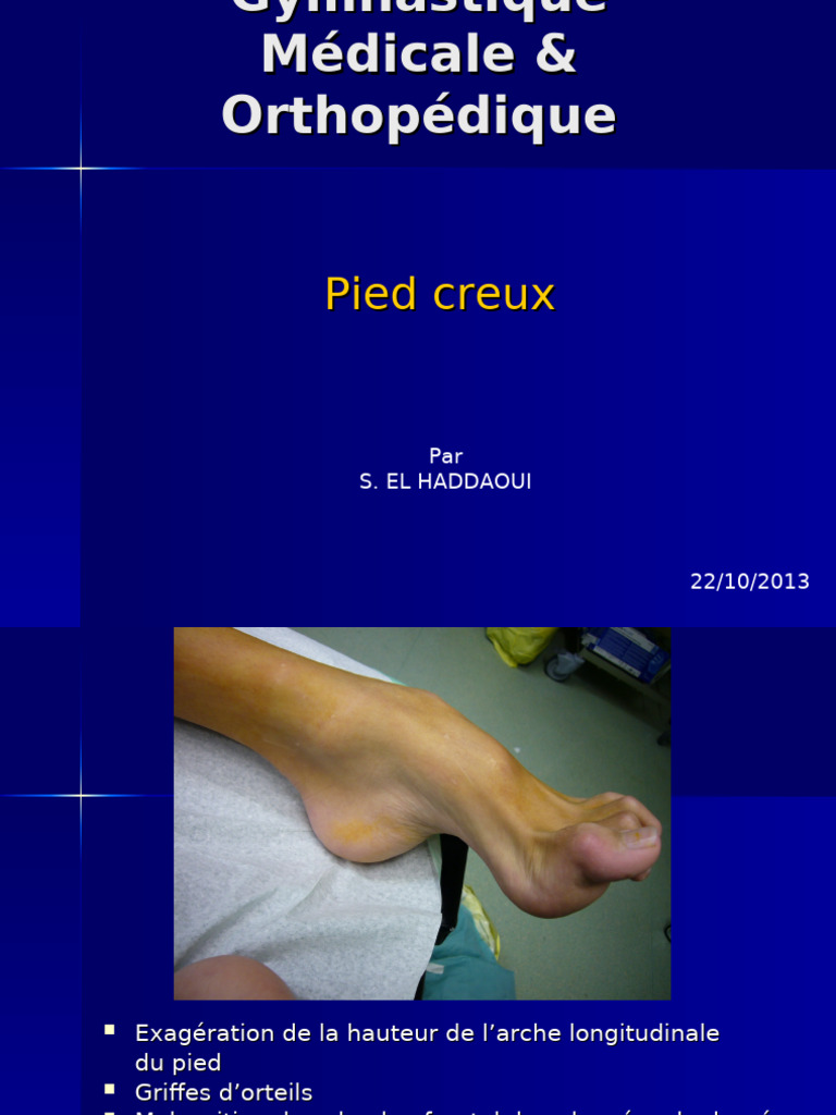 Pied Creux | PDF | Pied | Anatomie humaine