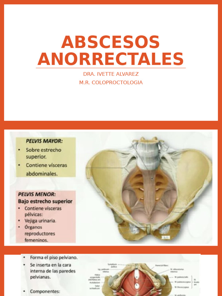 Abscesos y Fistulas Anorrectales | PDF | Cirugía | Enfermedad de Crohn