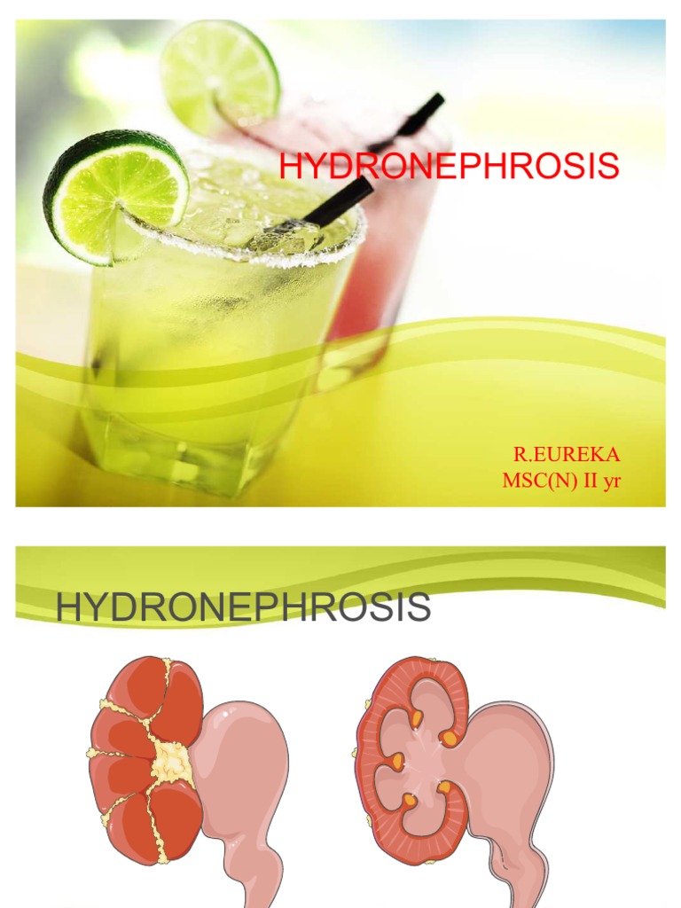 HYDRONEPHROSIS | PDF | Surgical Specialties | Animal Anatomy