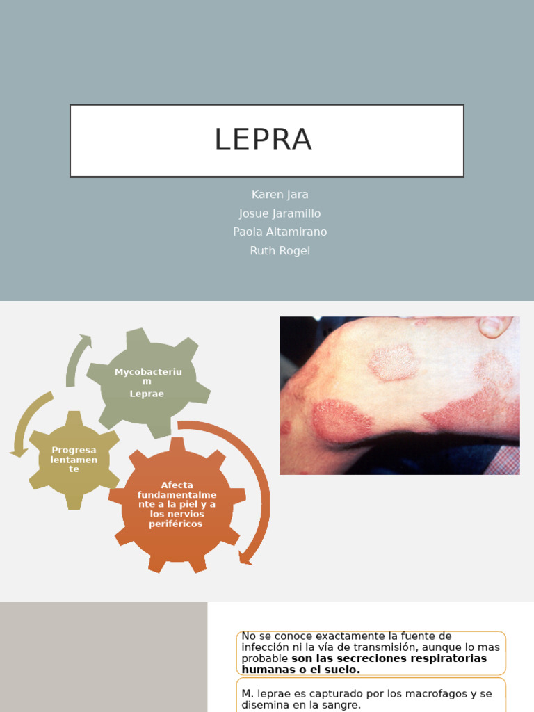 Lepra | PDF | Lepra | Inflamación