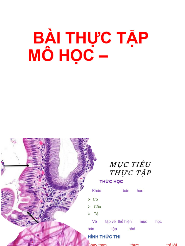 b1. Thuc Tap Bieu Mo-mo Lien Ket- Sun Xuong-than Kinh | PDF