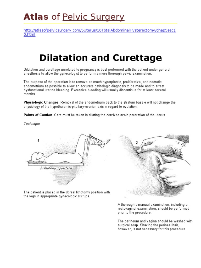 Atlas of Pelvic Surgery | Uterus | Human Reproduction