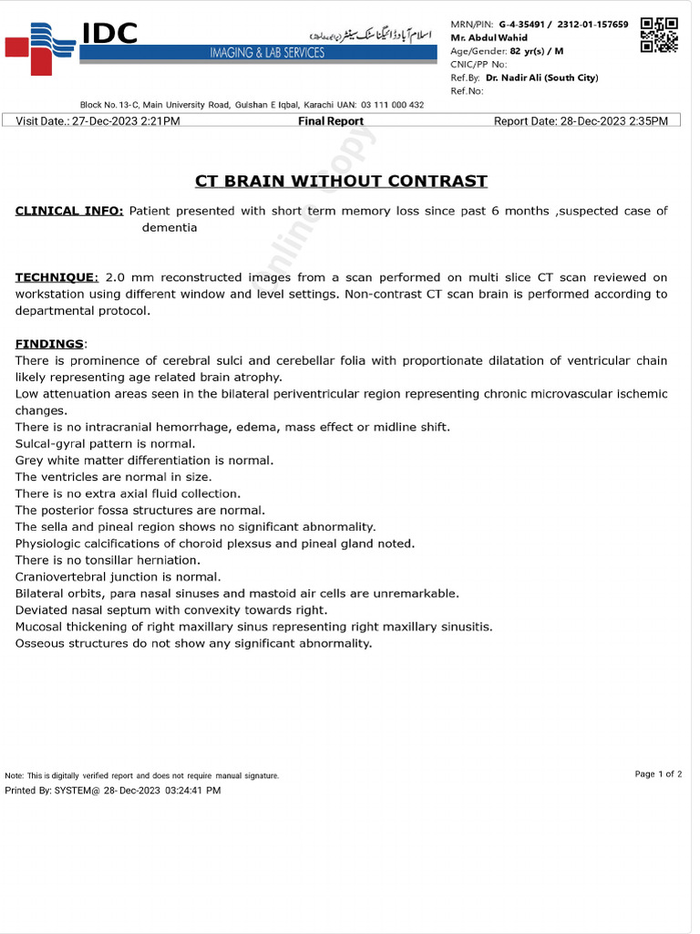 CTB - CT Scan For Brain-Abbu | PDF