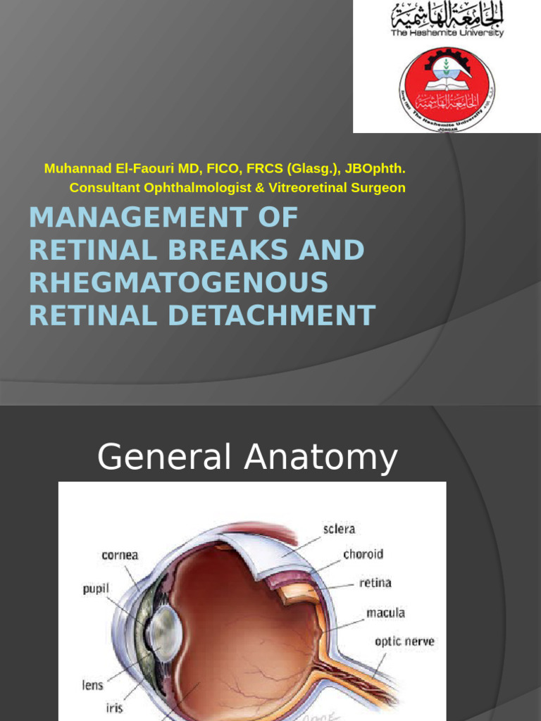Management of Retinal Breaks and Rhegmatogenous Retinal Detachment ...