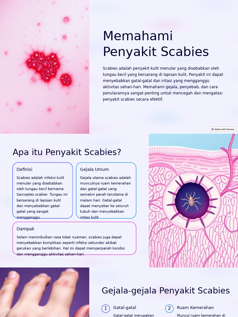 Memahami Penyakit Scabies | PDF