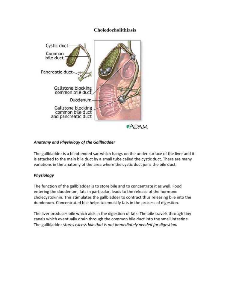 Choledocholithiasis | PDF