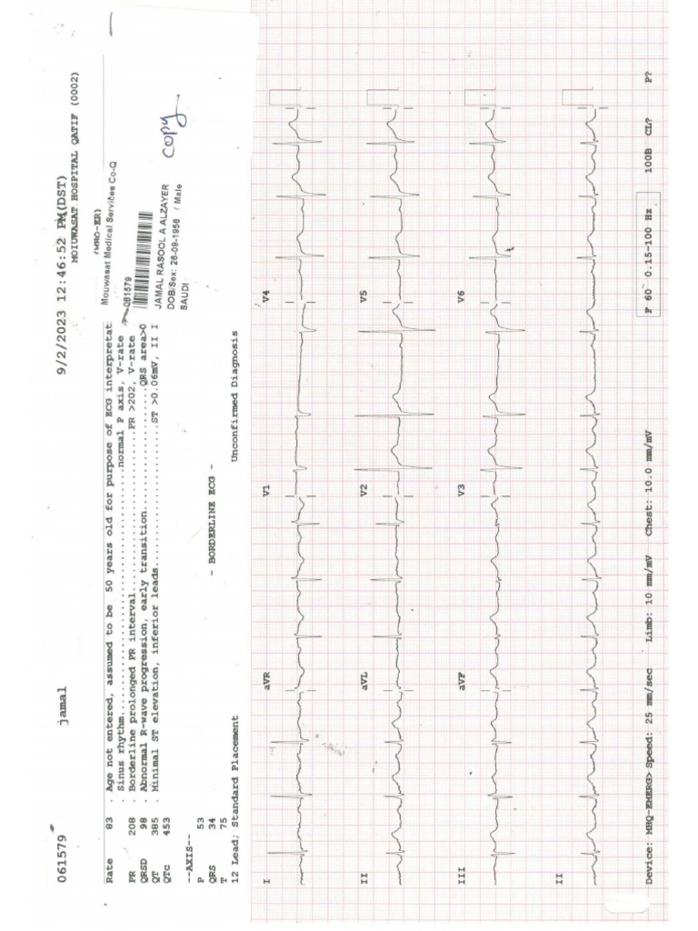 Jamal Ecg | PDF