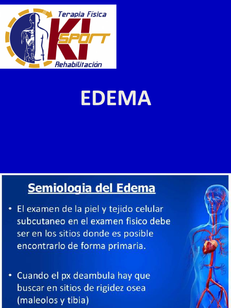 EDEMA | PDF