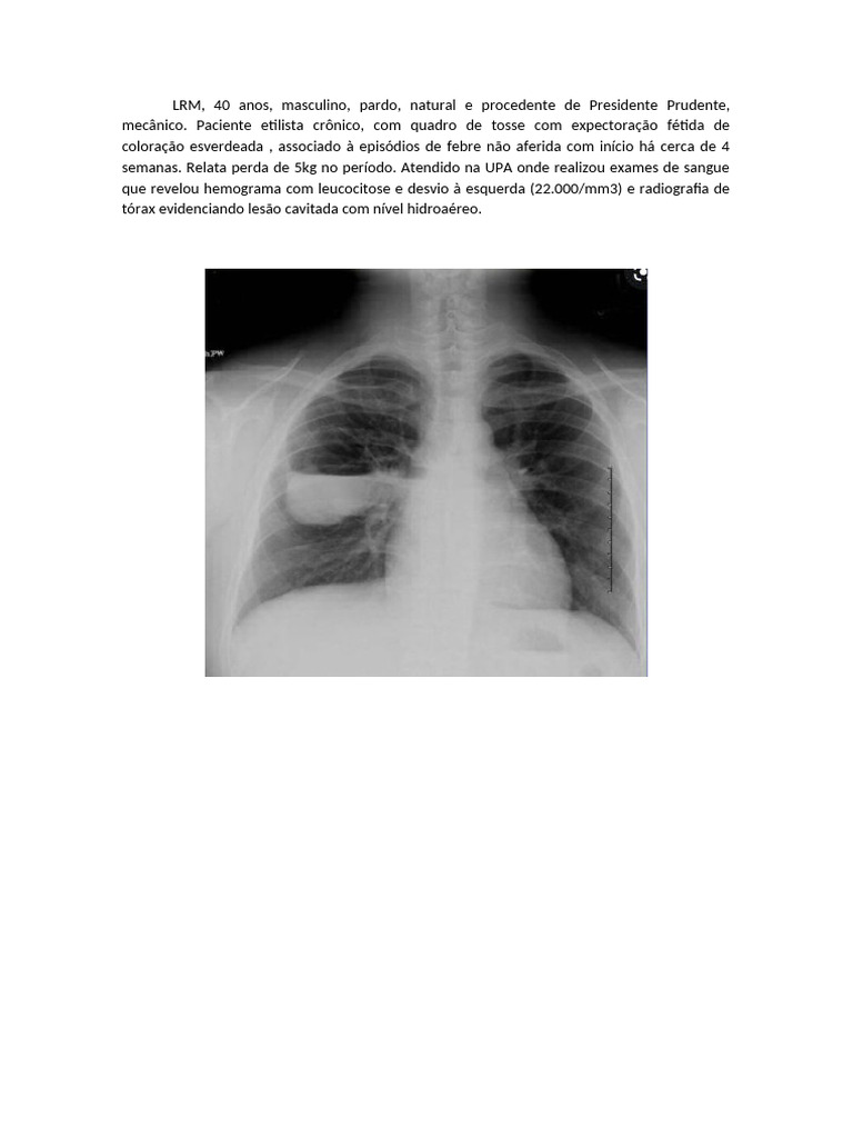 Vinheta Abscesso Pulmonar | PDF
