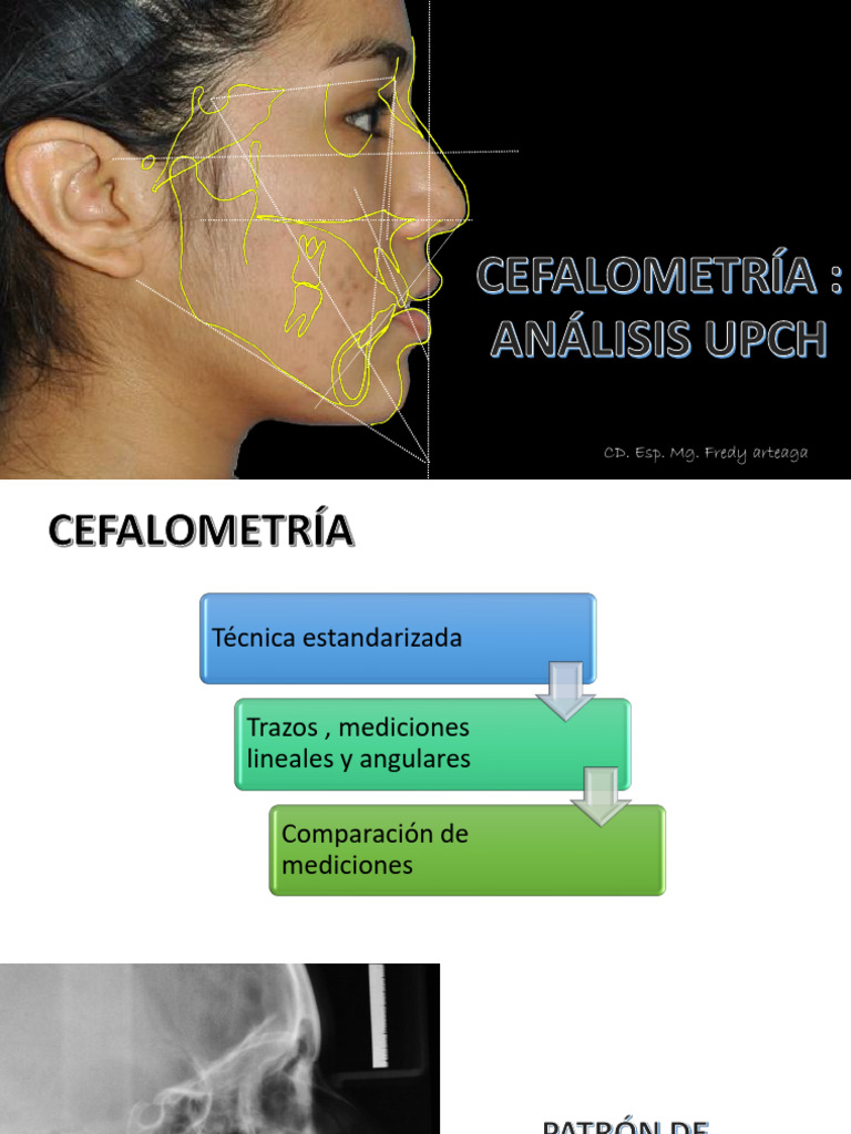 Análisis de Cefalometría en Ortodoncia | PDF | Sistema esquelético ...