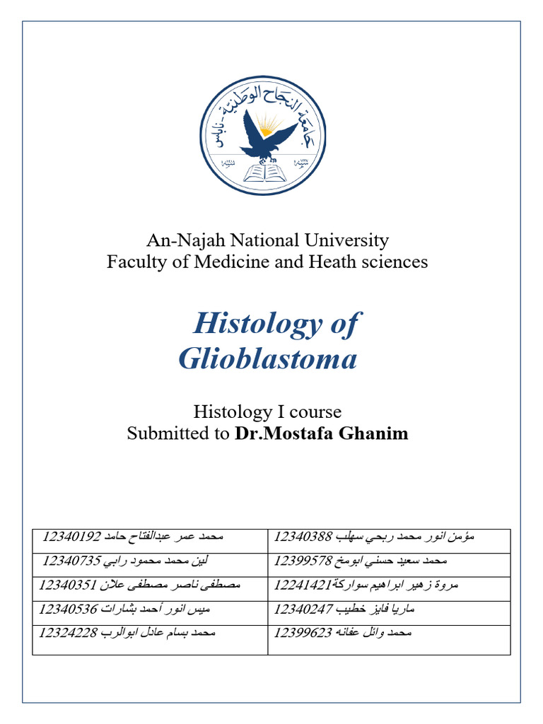 GLIOBLASTOMA histology - Dr.Ghanim | PDF | Astrocyte | Biopsy