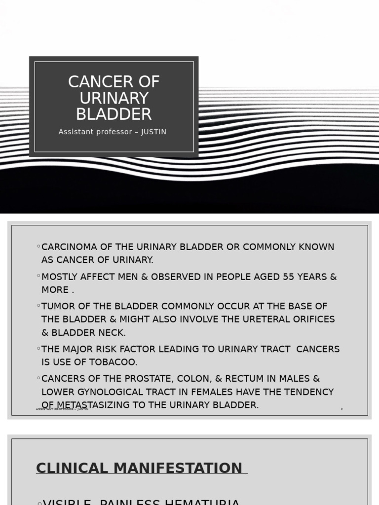 Urinary Bladder Cancer Overview and Care | PDF | Cancer | Clinical Medicine