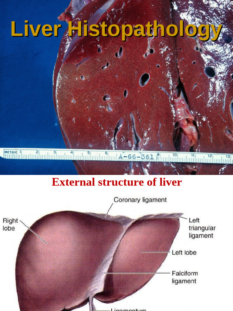 Liver Histopathology | PDF | Liver | Cirrhosis