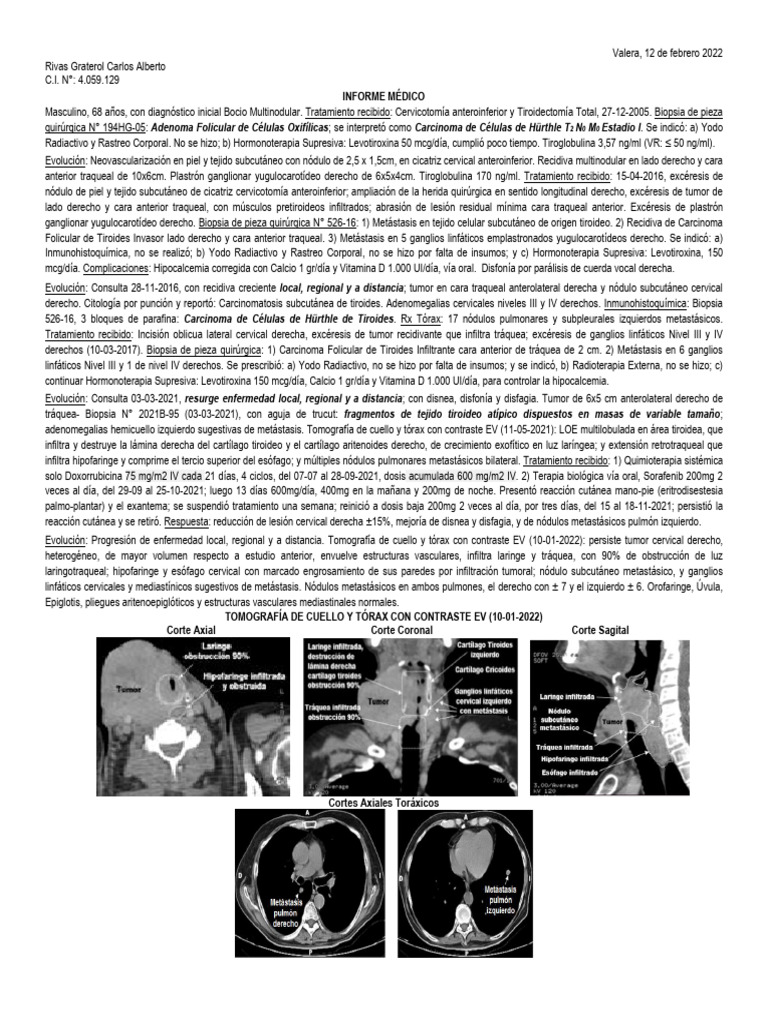 Informe Carlos A. Rivas Graterol | PDF | Metástasis | Tiroides