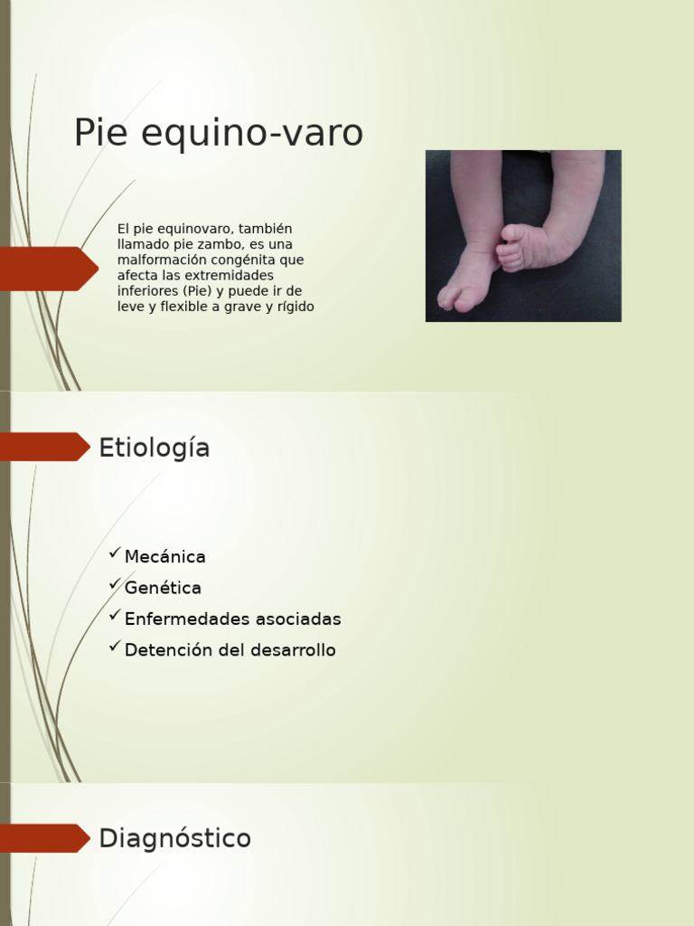 Clasificación y tratamiento del pie equino varo | PDF | Pie ...