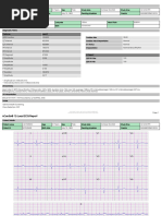 Sgarbossa Criteria - LITFL - ECG Library Diagnosis | PDF ...