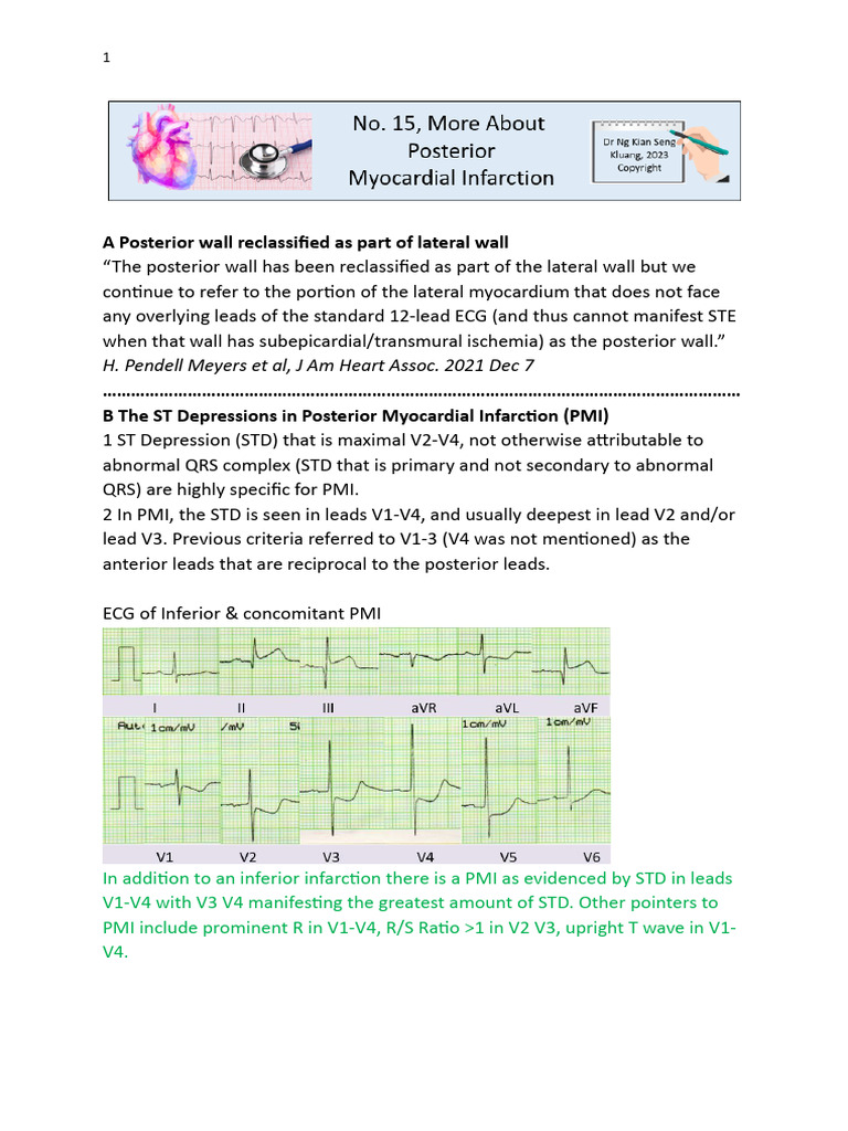 15 A More About Posterior MI | PDF | Electrocardiography | Myocardial ...