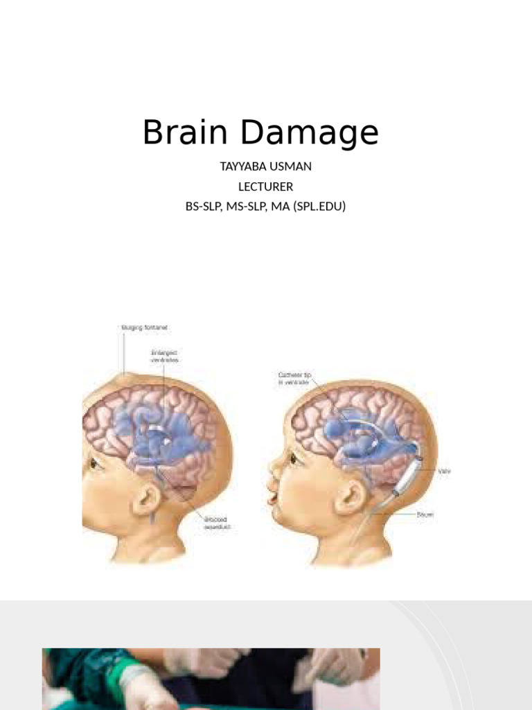 Lec7 Brain Damage | PDF | Medicine | Human Diseases And Disorders