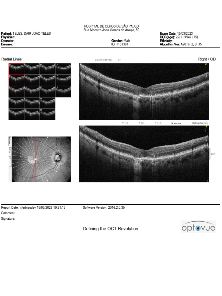 Radial Od | PDF