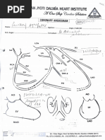 Angiogram Report Apollo | PDF | Angiography | Coronary Artery Bypass ...
